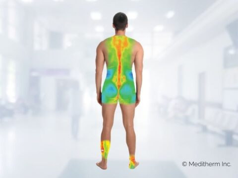 Full Body Scan | perspectivethermography.com